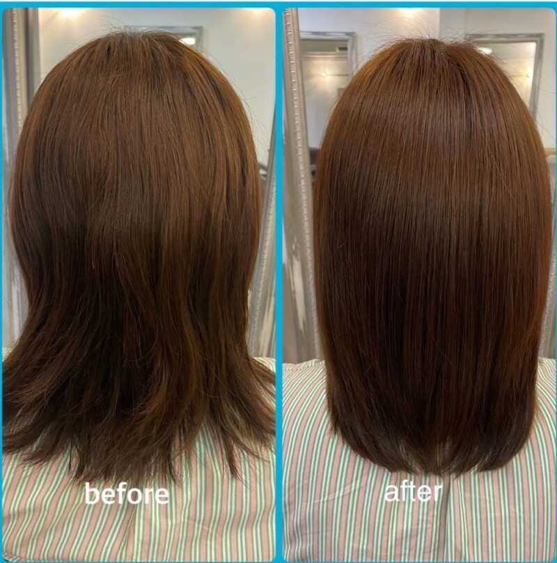 ☆acid heat treatment☆ | Singapore Maxwell MRT Beauty Salon Key's